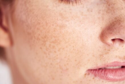 How does the skin function? Urgo Medical will tell you more about it.